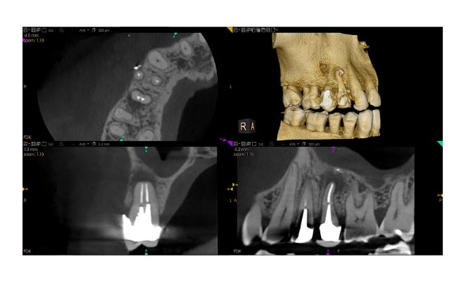 Advanced Technology - Priority Endodontics